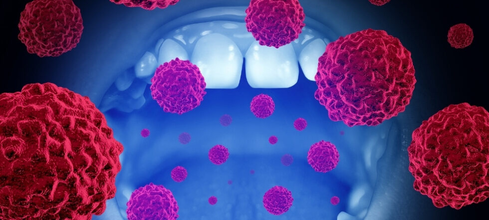 The Mouth–Mood Connection: Could Oral Bacteria Be Linked to Depression ...